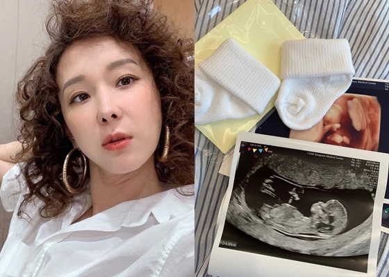 둘째 임신 이지혜 초음파 사진 공개 꼬물꼬물 잘 자라요 [n샷] 머니투데이