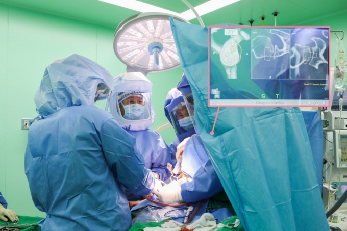 Reverse Artificial Joint Replacement: A Promising Treatment for Rotator ...