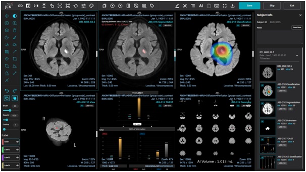 제이엘케이 'JBS-01K', 동두천 중앙성모병원 도입…의료서비스 혁신 주도 기대 - 머니투데이