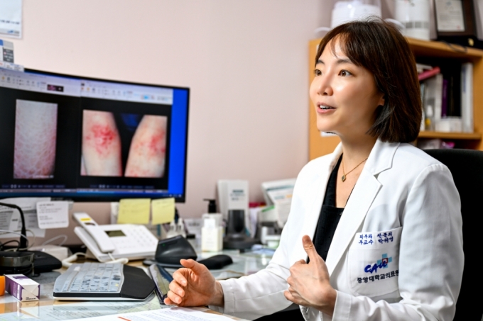 보습제와 성분 비슷한데…MD크림은 왜 '의사 처방'이 필요할까? - 머니투데이